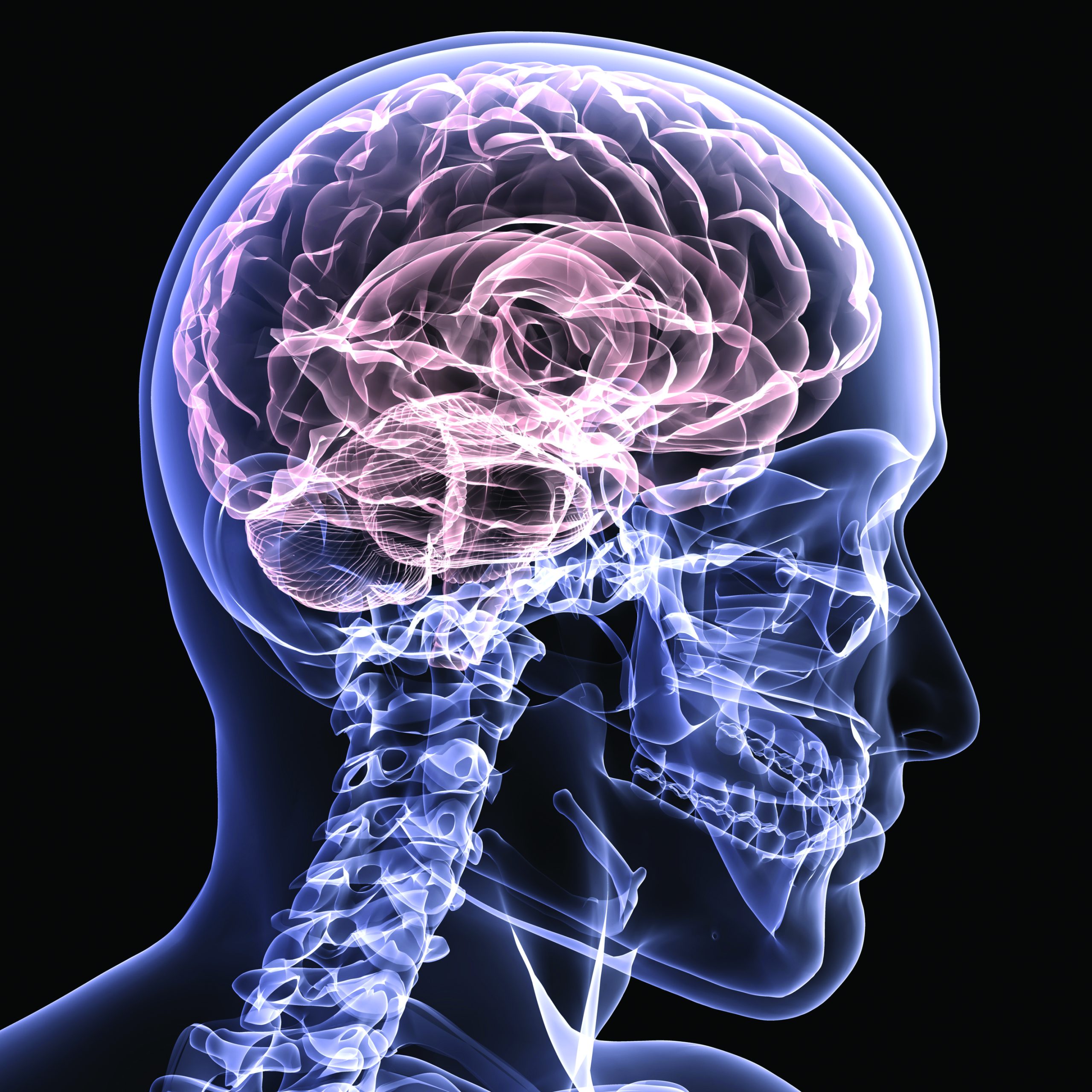 Tremblement orthostatique : une pathologie cérébelleuse ? - Aptes